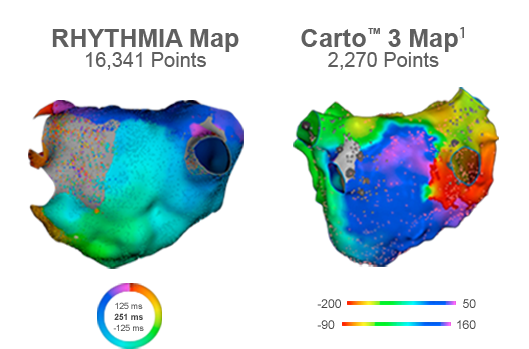 Cardiac Mapping System – RHYTHMIA HDx - Boston Scientific